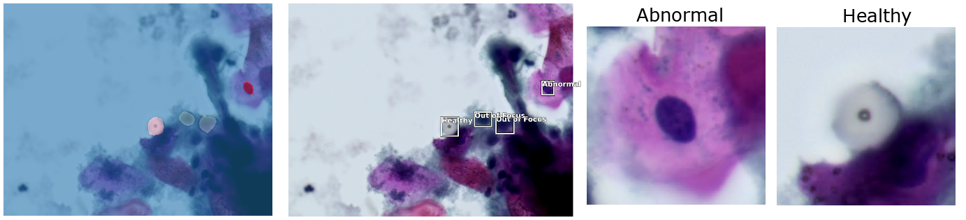 Papanicolaou Stained Slides Analysis